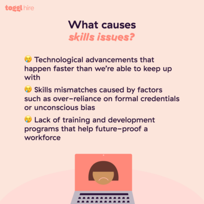 What Does 'Skill Issue' Mean in the Workplace? • Toggl Hire